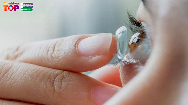 Top 6 địa điểm bán kính áp tròng Thanh Hóa bảo vệ đôi mắt